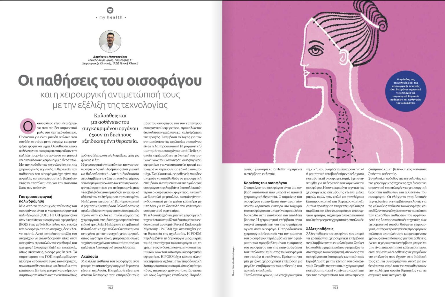 Παθήσεις του οισοφάγου και αντιμετώπιση • Δ. Μπισταράκης MD
